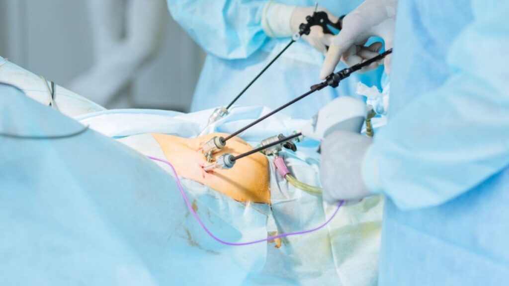 Hysterectomy (Uterus removal) – Dr. Richa Arora Miglani